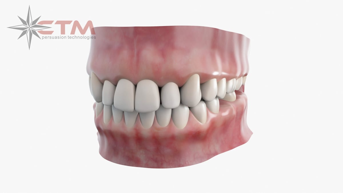 Dental Animations by California Technical Media: Transforming Oral ...