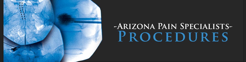 Arizona Pain Specialists- Procedures on Vimeo
