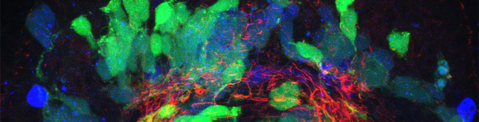 Dr. Michael Barresi on Vimeo