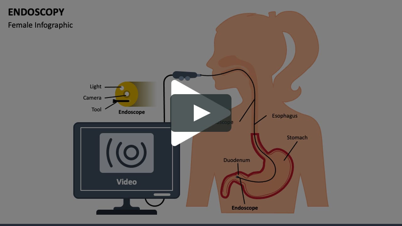 Endoscopy Animated Presentation - SketchBubble on Vimeo