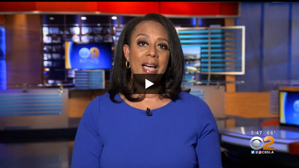 Amy Johnson Breast Cancer Journey - Dr Jason McKellop on KCBS | RadNet TV