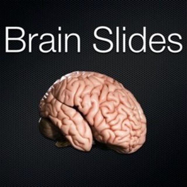 Brain Slides