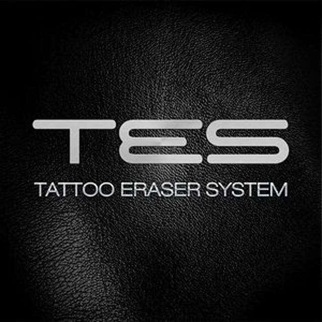 tattooerasersystem