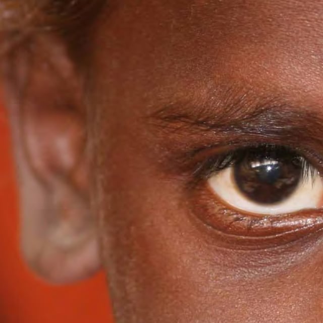 Indigenous Eye Health Unit IEHU