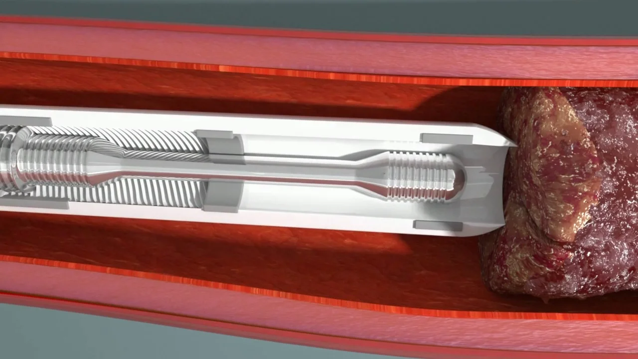 CapBuster Animation EN on Vimeo