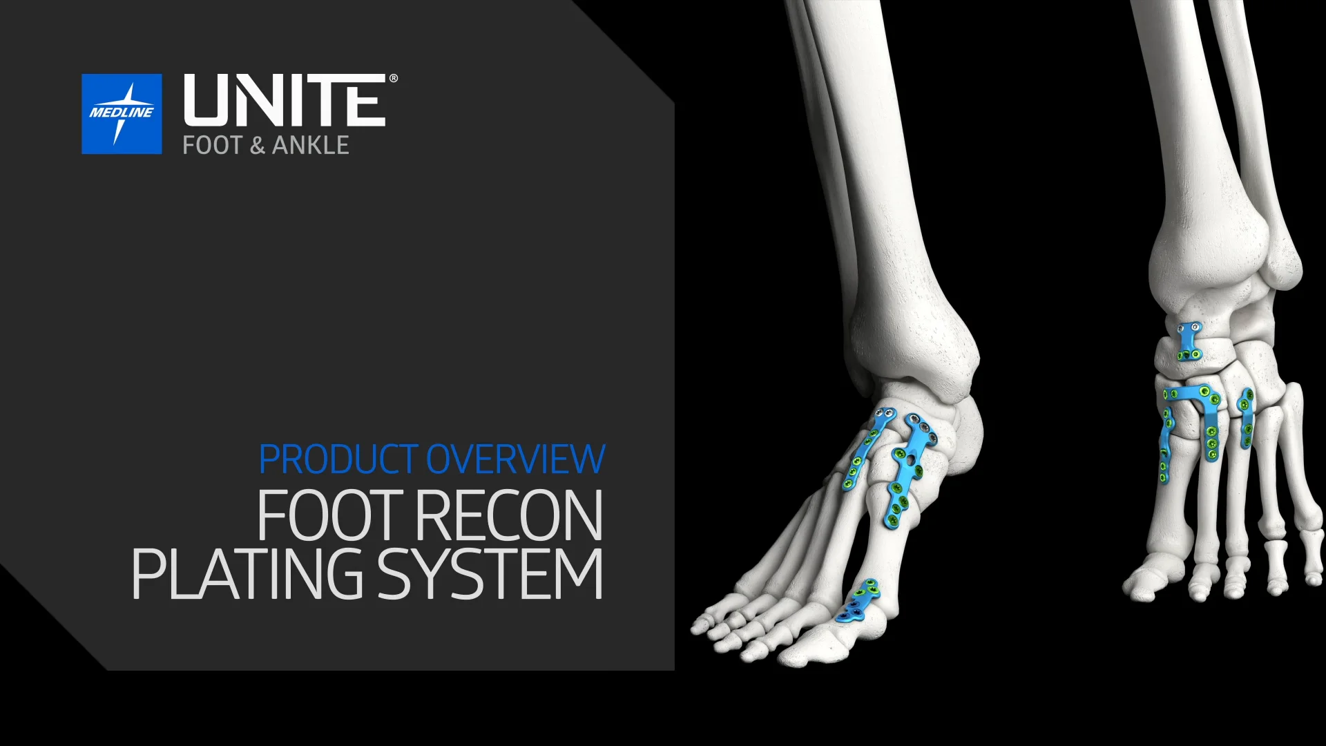 Medline Unite Foot Plating System Overview