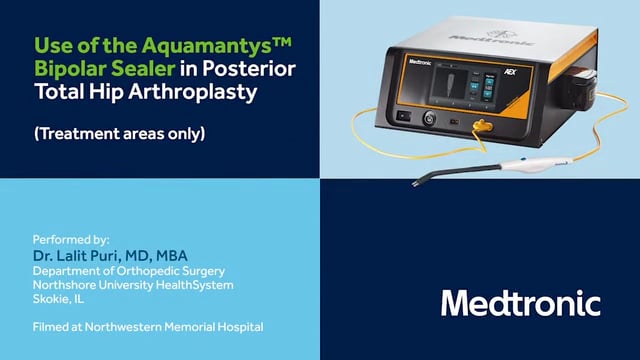 Orthopaedic Reconstruction - Medtronic Advanced Energy on Vimeo