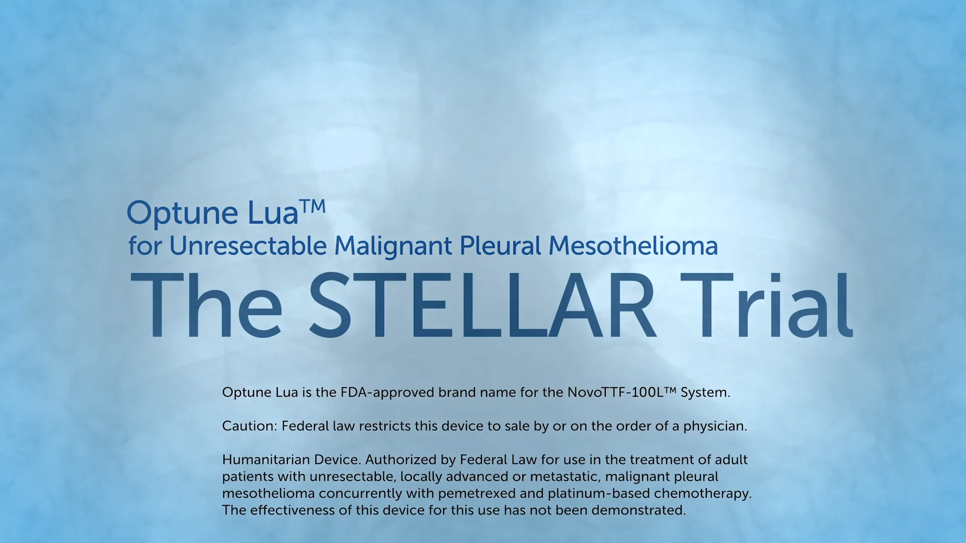 Optune Lua - The STELLAR Trial on Vimeo