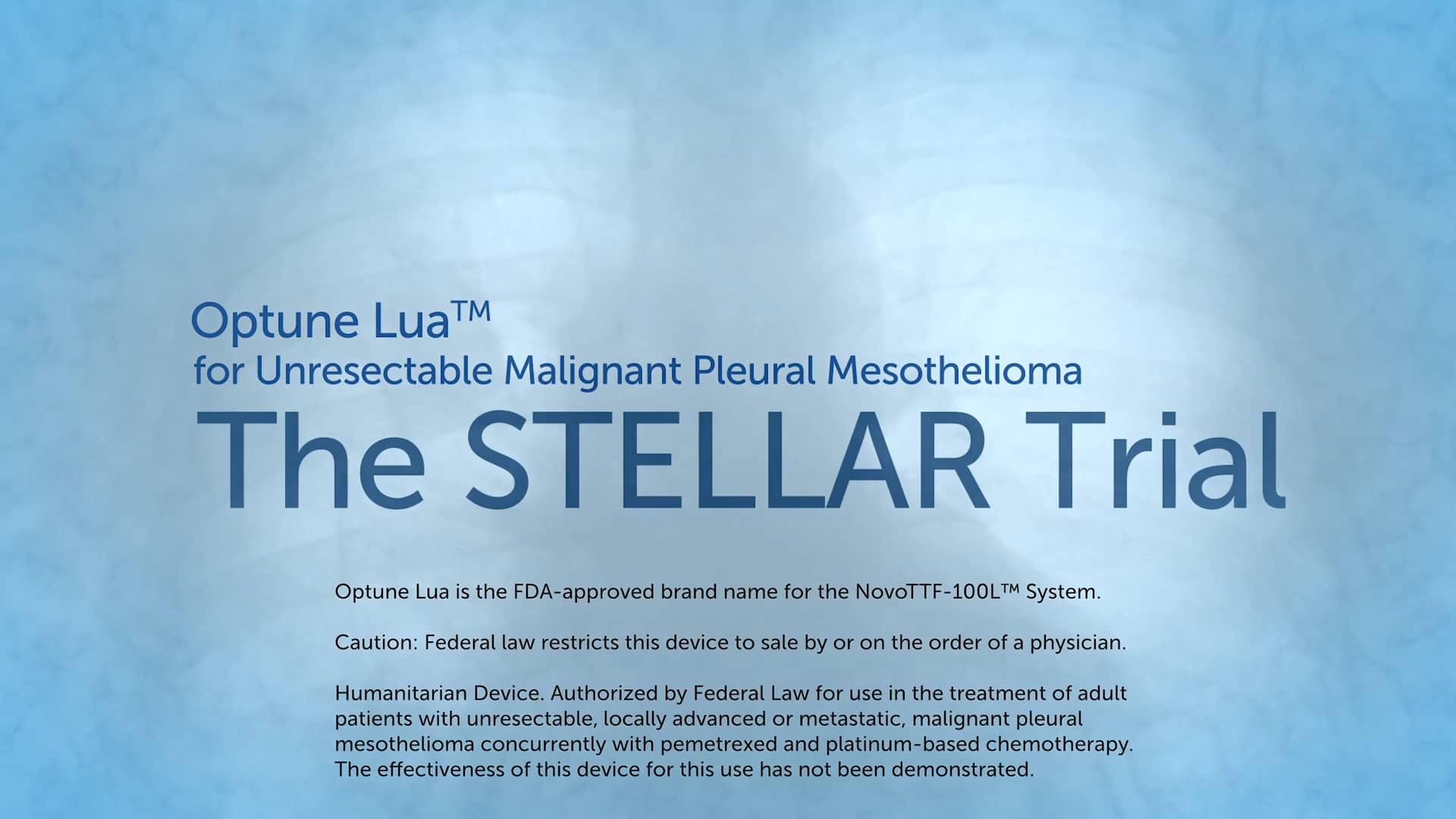 Optune Lua - The STELLAR Trial on Vimeo