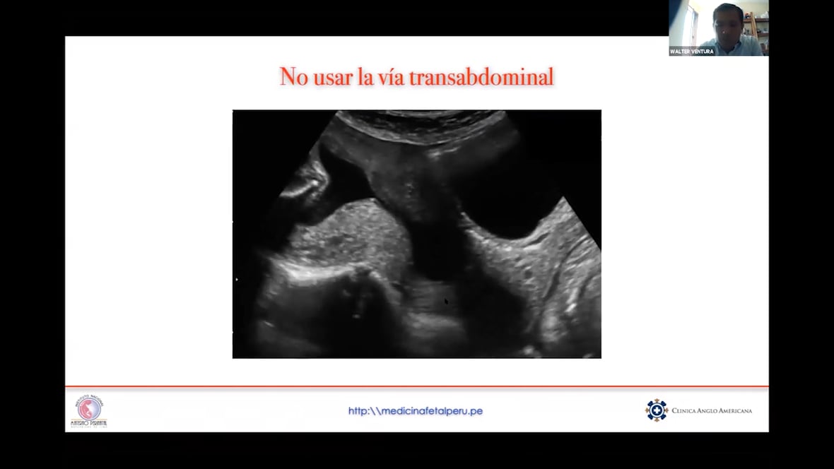 Modulo 3-2 Tecnica Adecuada Para Medir La Longitud Cervical Dr Walter ...