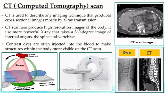 Medical Imaging using Ionizing radiation - الفيزياء الحيوية | Najah Videos