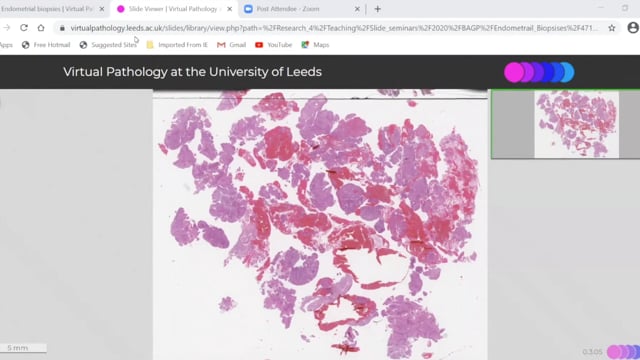 Uterine Corpus – The British Association of Gynaecological Pathologists