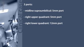 Laparoscopic intraperitoneal onlay mesh repair (IPOM) plus technique in ...