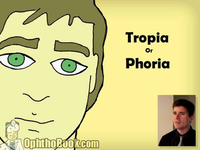 Ophthalmology Lecture - Tropias & Phorias on Vimeo