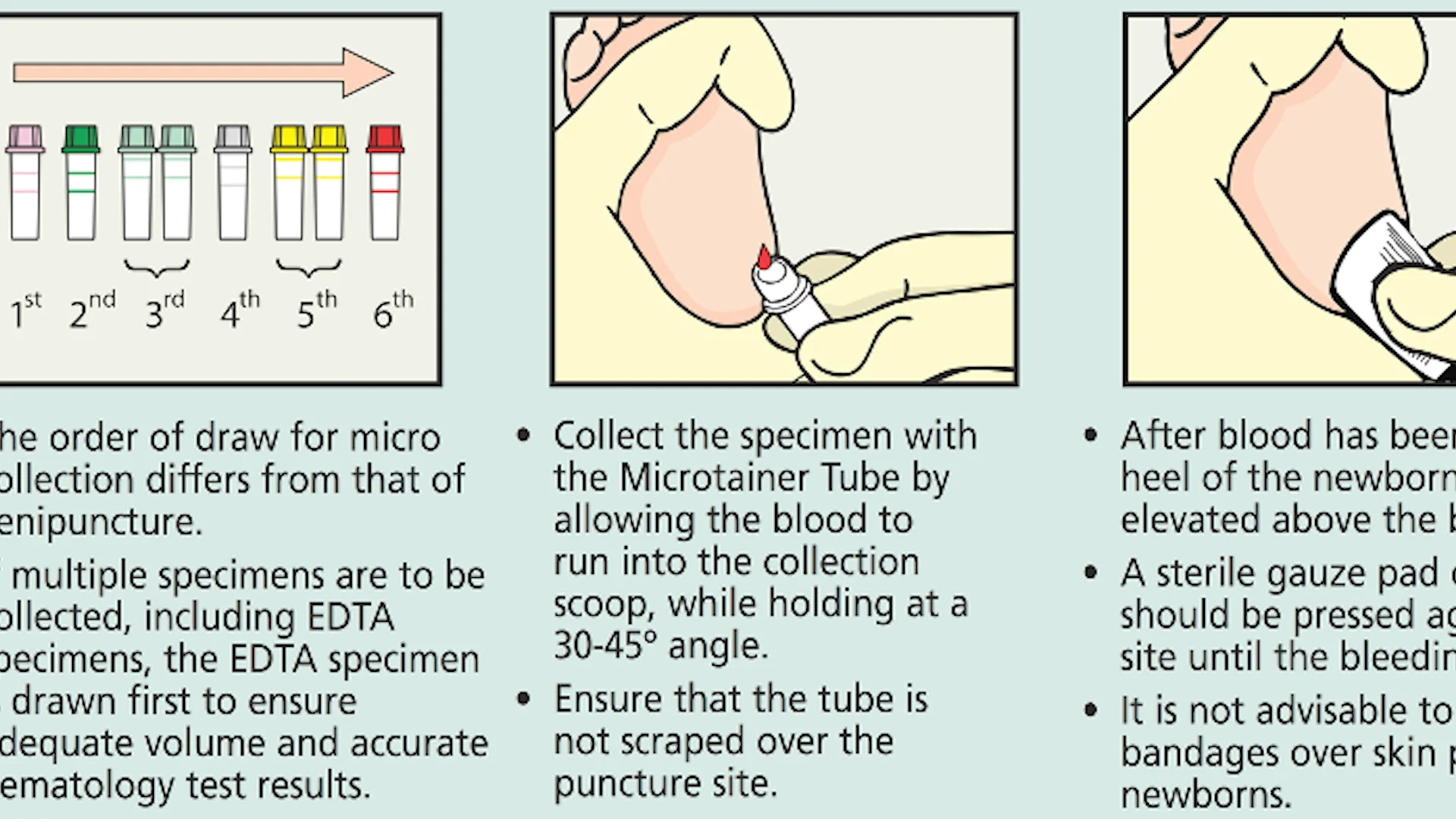 Module 19 - Essential Extras: Section 2 - Filling BD Microtainer Tubes ...