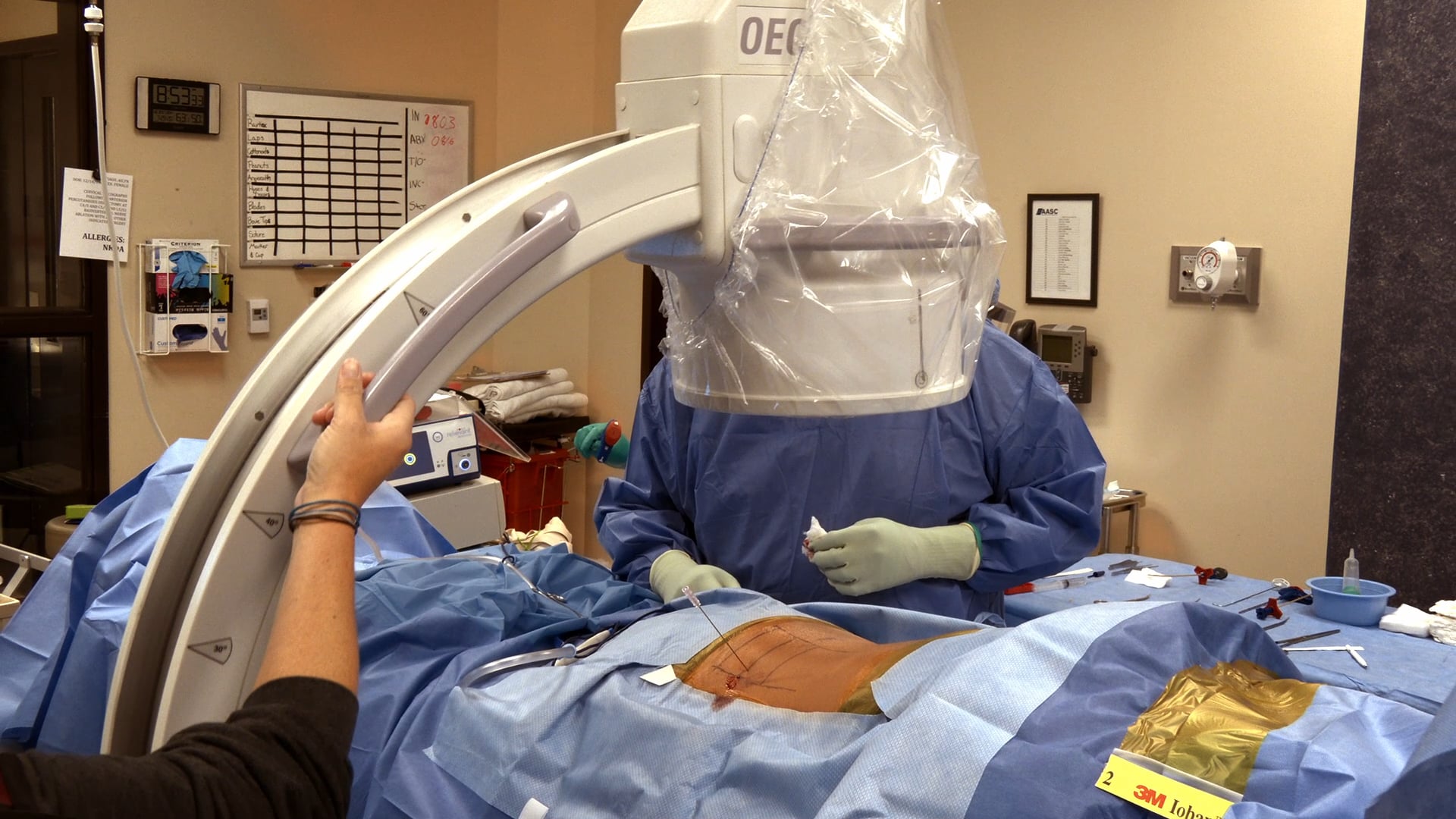 Dr Lorio What is the Intracept Procedure AASC