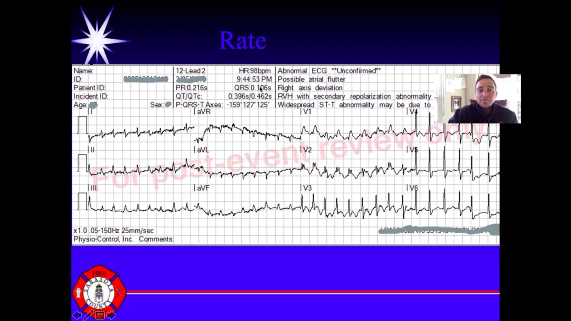 SCFD ECG Training - Part 1 on Vimeo