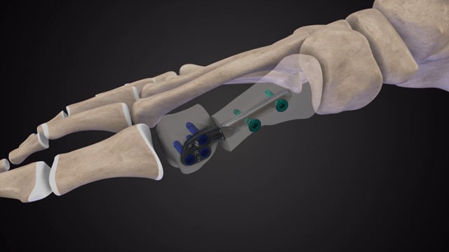 Resources | Novastep