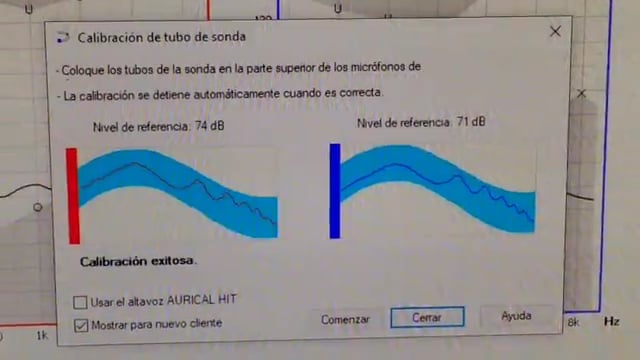 20210126 pruebas REM on Vimeo