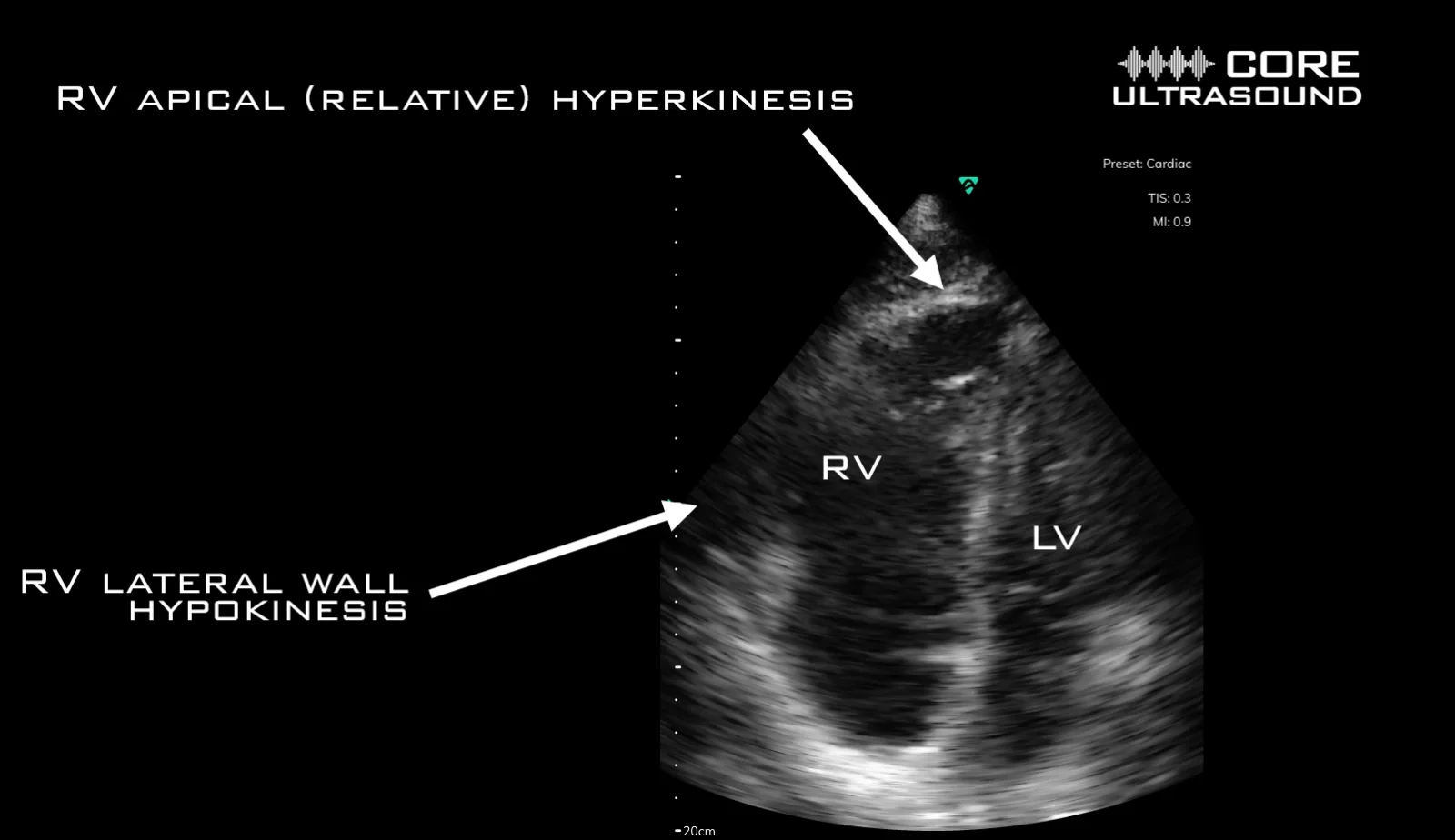 McConnell's sign explanation on Vimeo
