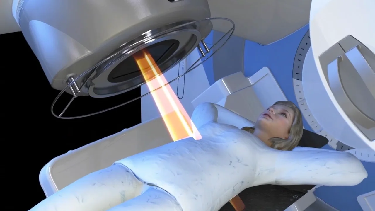 Elekta Oncology – Versa HD