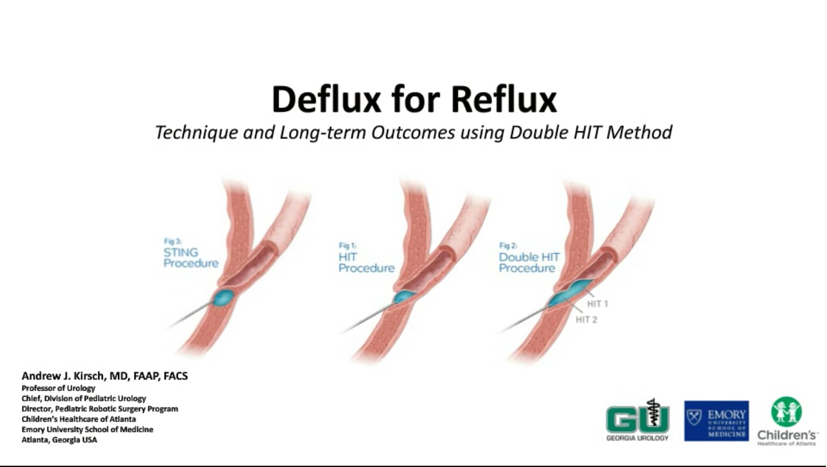 Deflux Injection Training with Dr. Kirsch on Vimeo