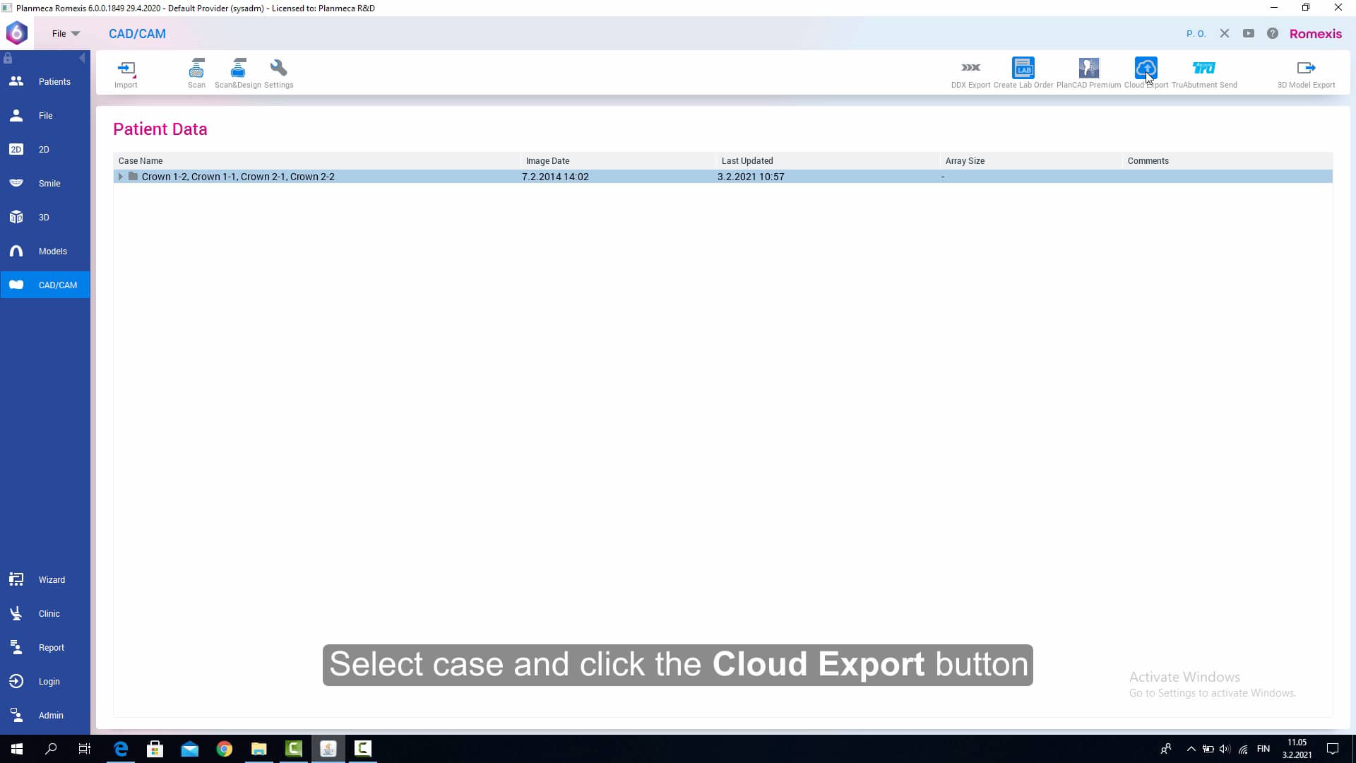 How to - Send case to Romexis® LabApp from Romexis on Vimeo