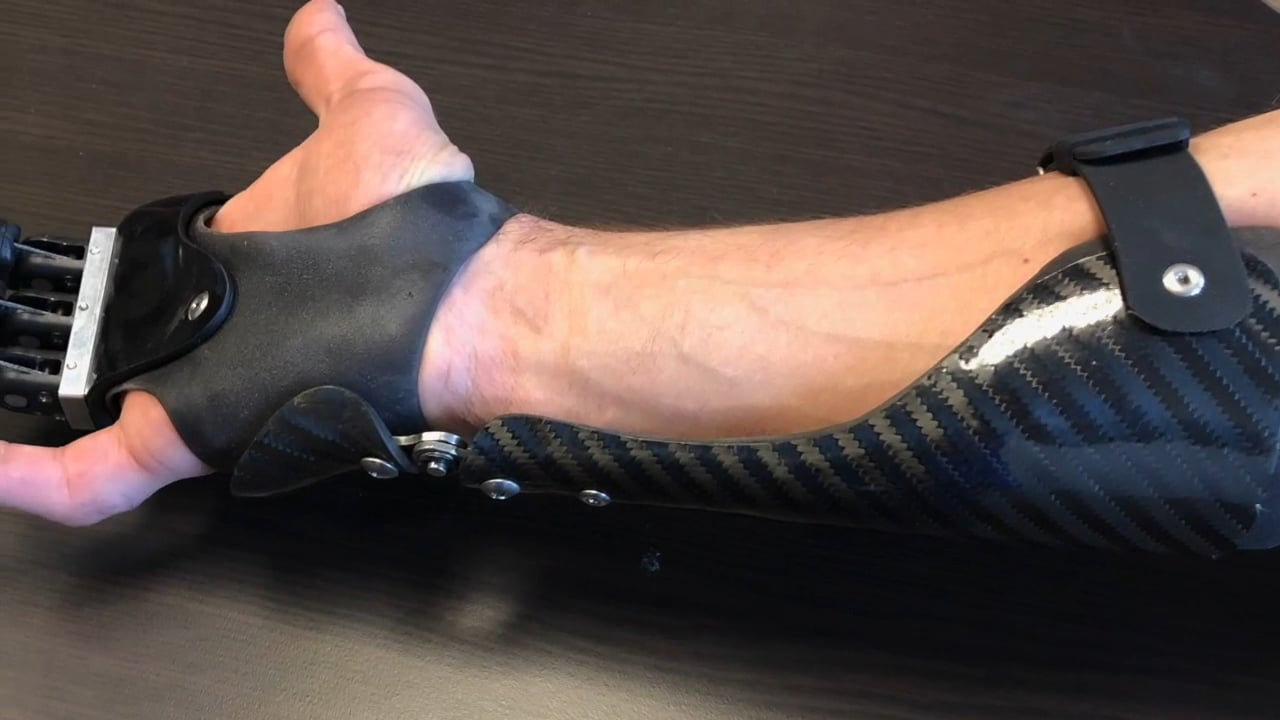 Partialhandsolutions - Prosthetic Finger, Partial Hand