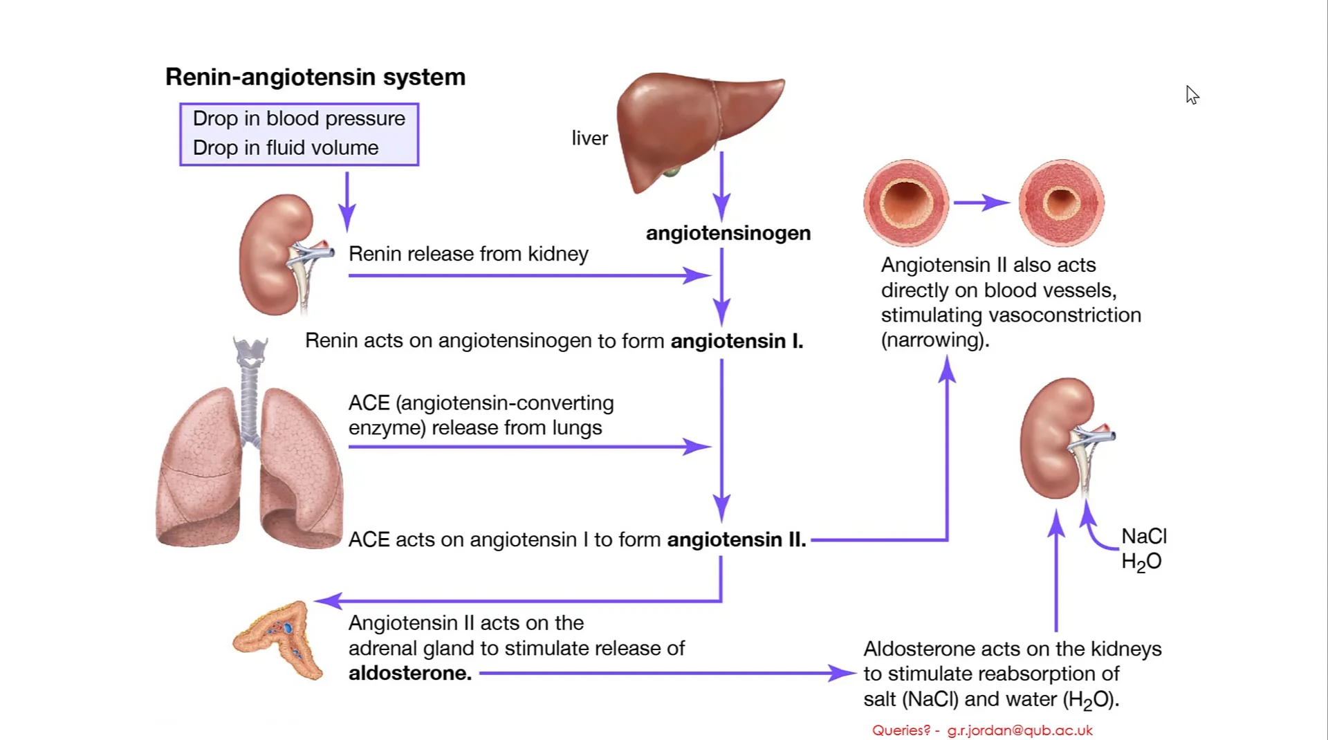 RAS system