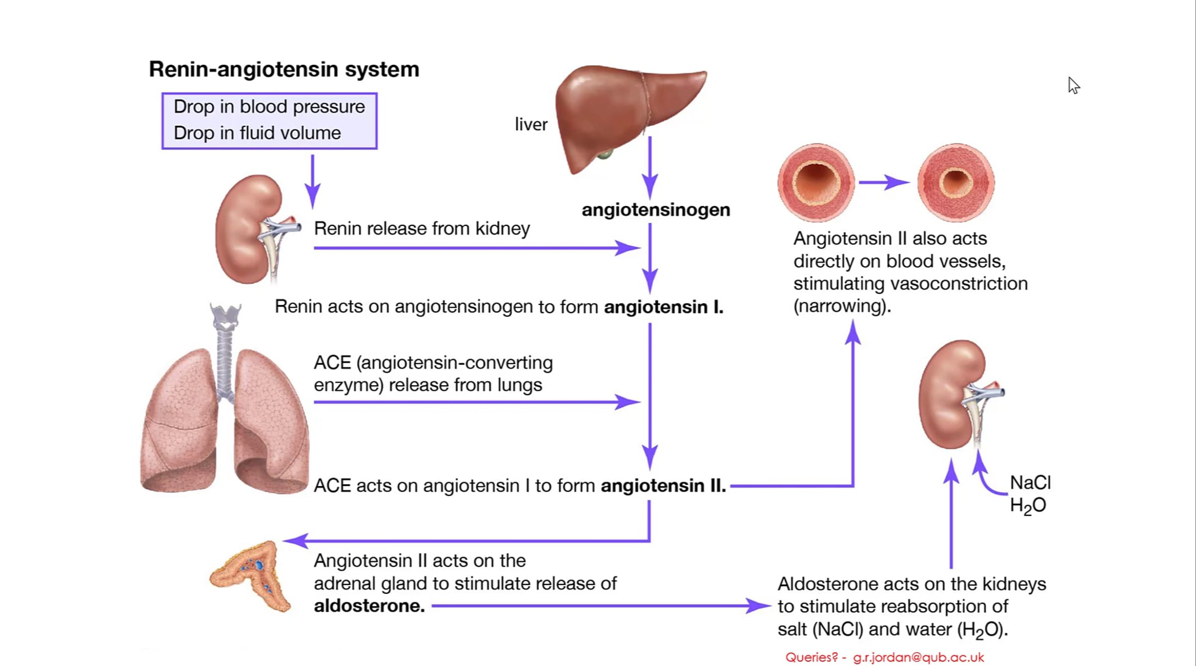 RAS system