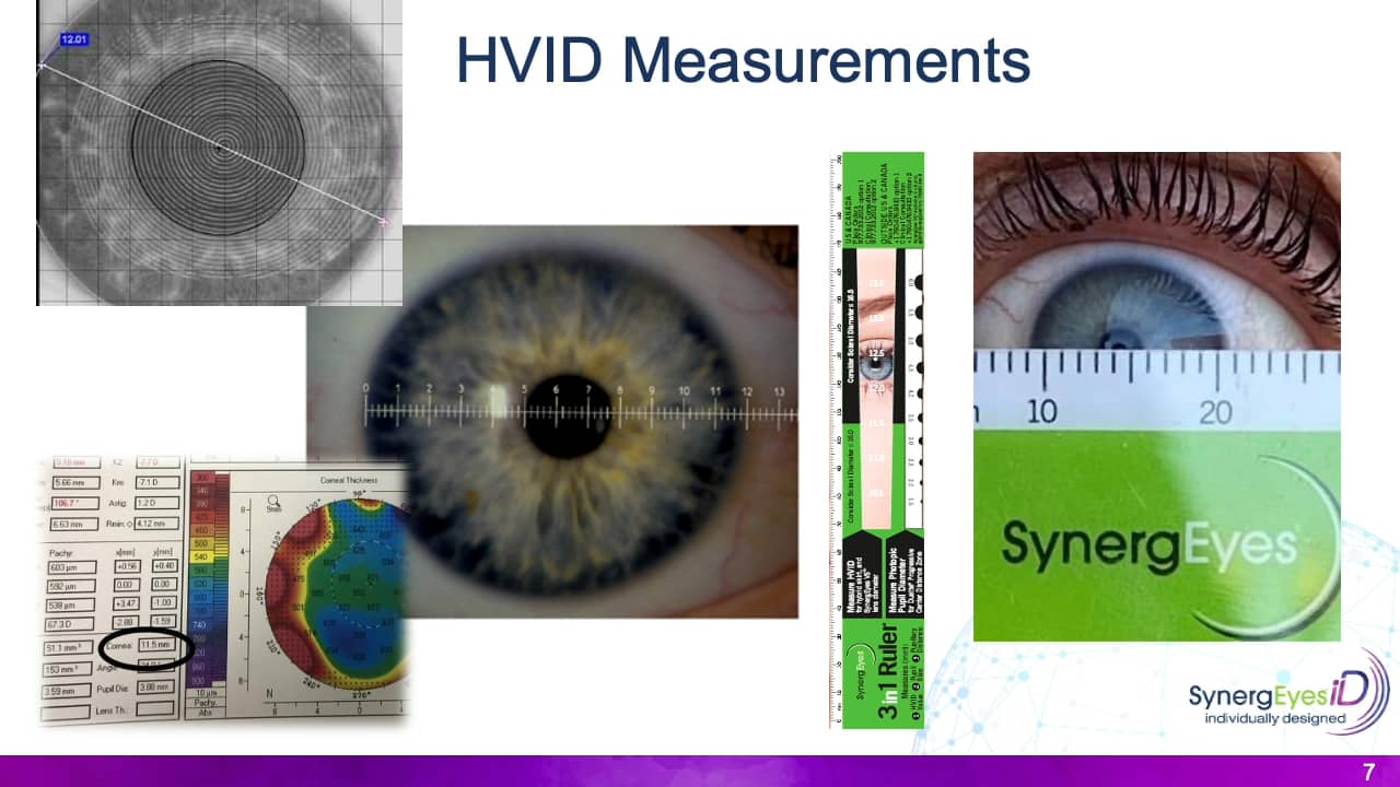 HVID: Its Importance and How to Measure on Vimeo
