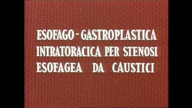 502/100 Esofago-Gastroplastica Intraoperatoria per Stenosi Esofagea da ...