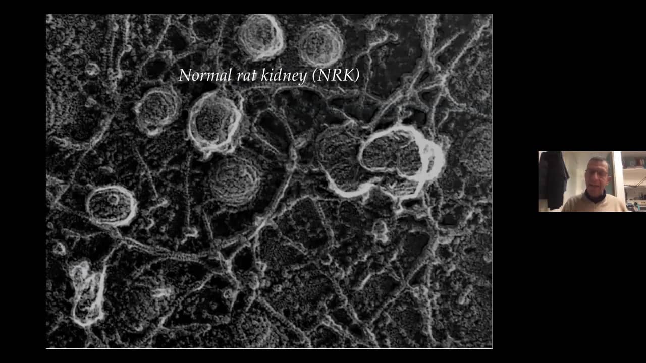 Dr. Christophe Lamaze, LSI Virtual Seminar: Mechanotransduction by ...