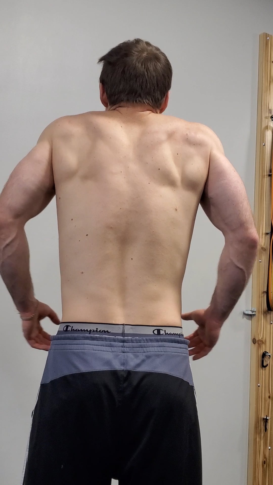 Scapular CARS - Forward on Vimeo