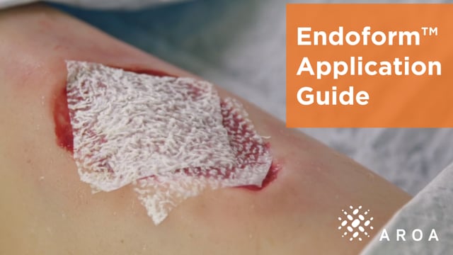 Endoform™ | AROA