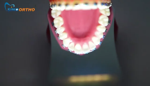 dental mirror defogger - anti fog dental mirror - dental mirror with ...