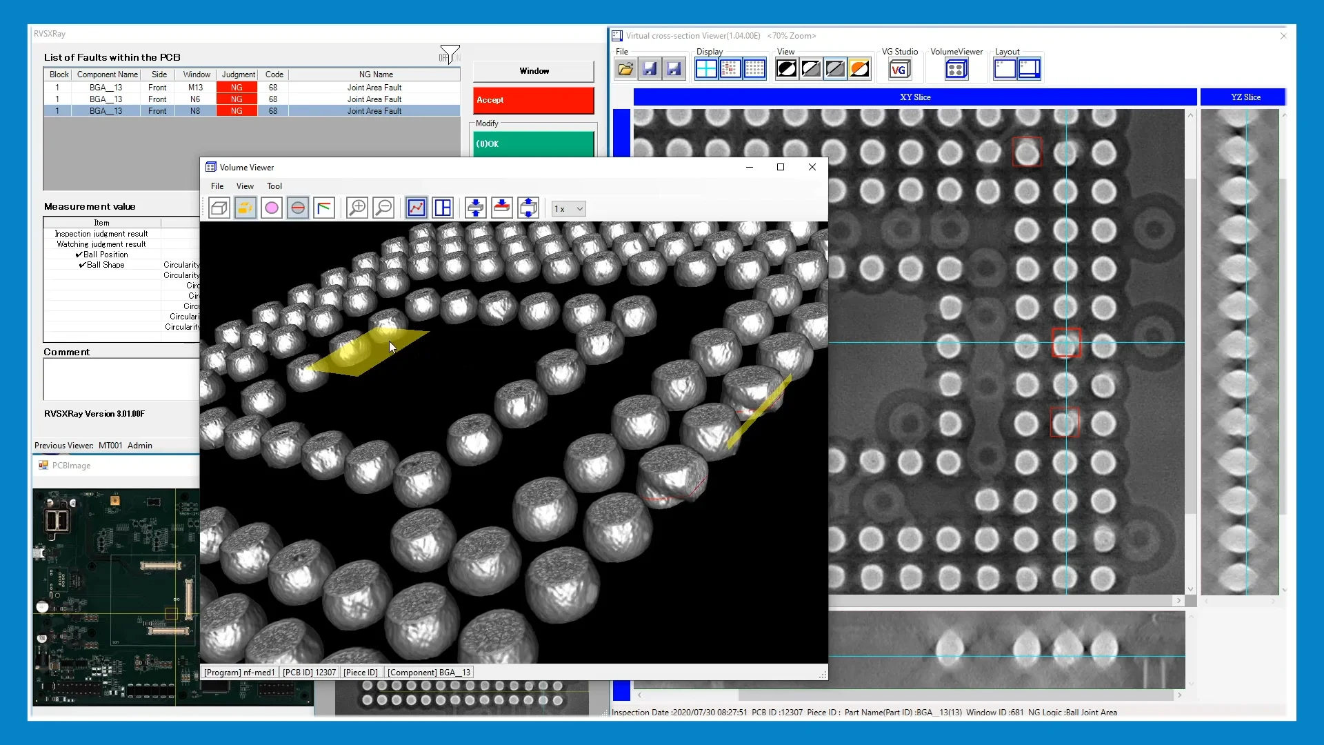 OMRON VT-X750 3D CT AXI PART 1 V6.mp4 on Vimeo
