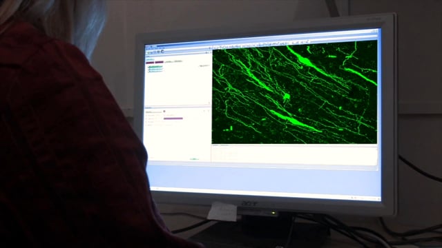 Confocal microscopy of neurons — Science Learning Hub