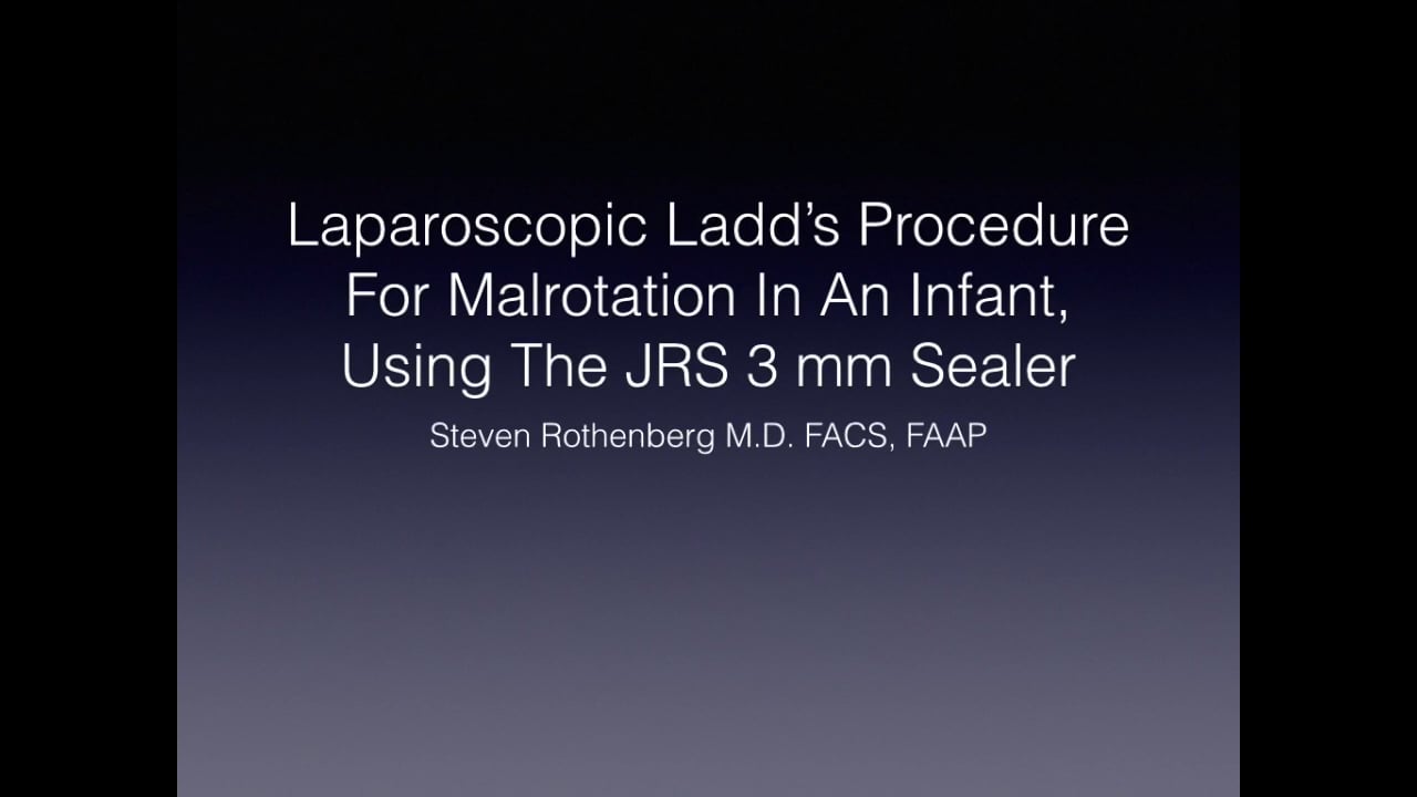 Laparoscopic Ladd’s for Malrotation on Vimeo