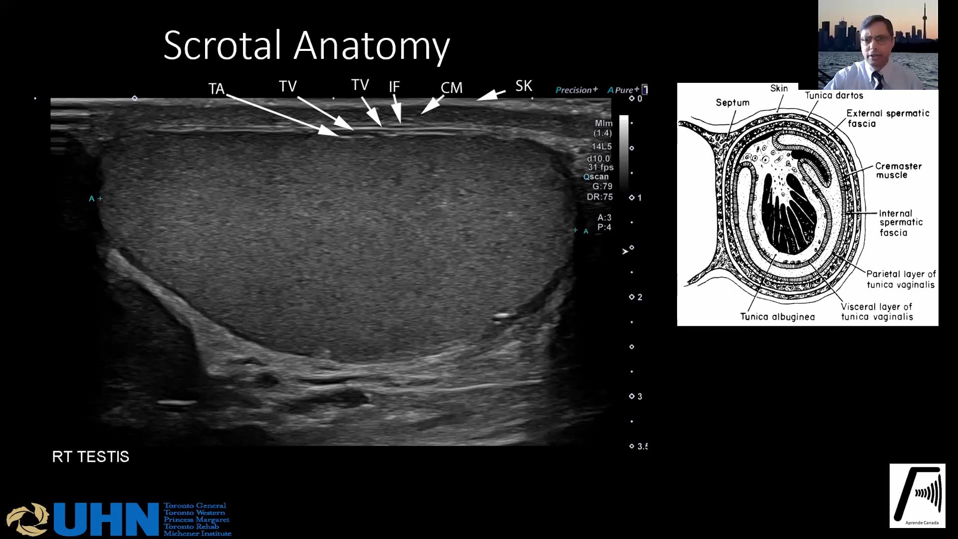 Watch TRAILER Ultrasound of the Scrotum Online | Vimeo On Demand on Vimeo