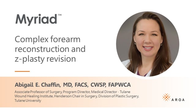 Myriad Matrix™ | AROA