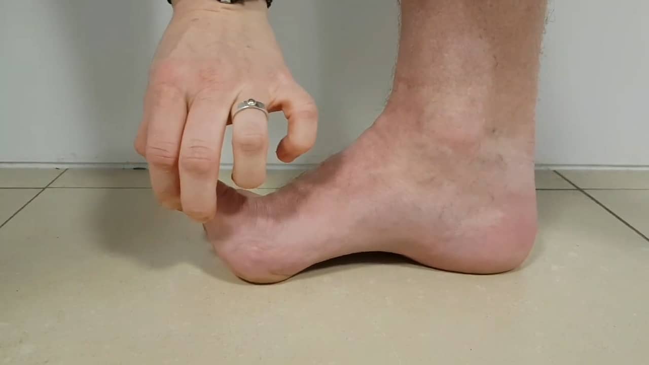 The Hubscher maneuver on Vimeo