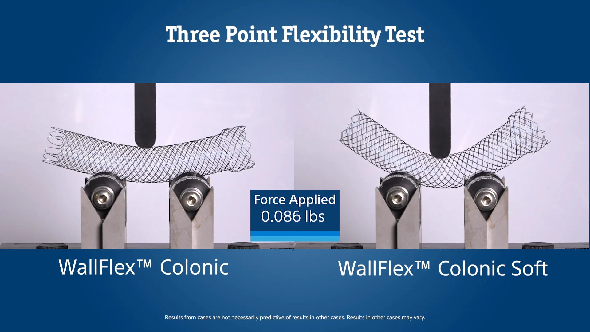 Wallflex™ Colonic Stent Three Point Flexibility Test