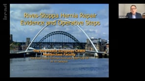 Rives-Stoppa hernia repair: evidence and operative steps | WebSurg, the ...