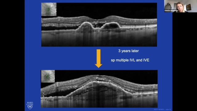 NC Retina Club on Vimeo