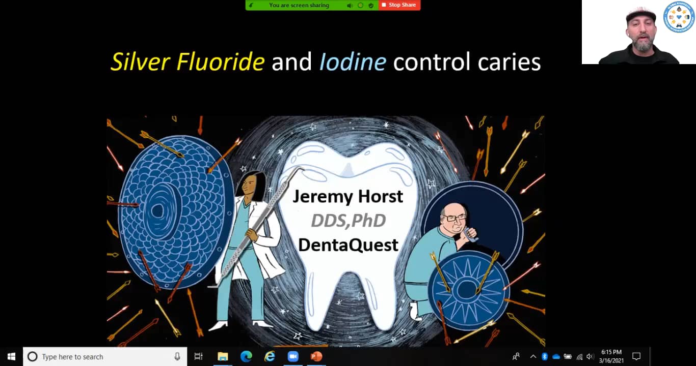 Jeremy Horst - Silver Fluoride and Iodine Control Caries on Vimeo