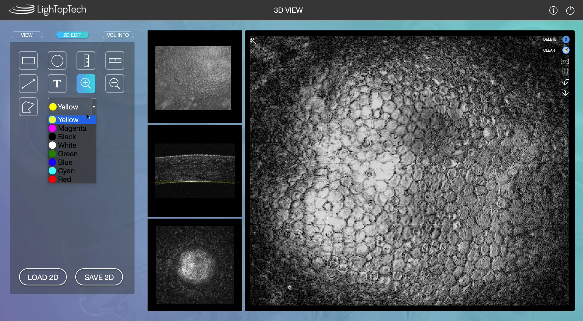 Measurement features in Viewer 4D™ on Vimeo