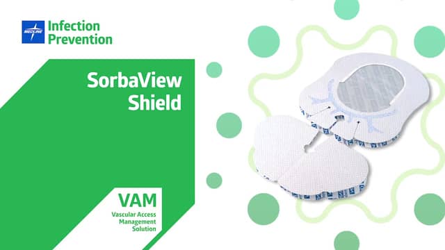 SorbaView Shield Promo Video on Vimeo