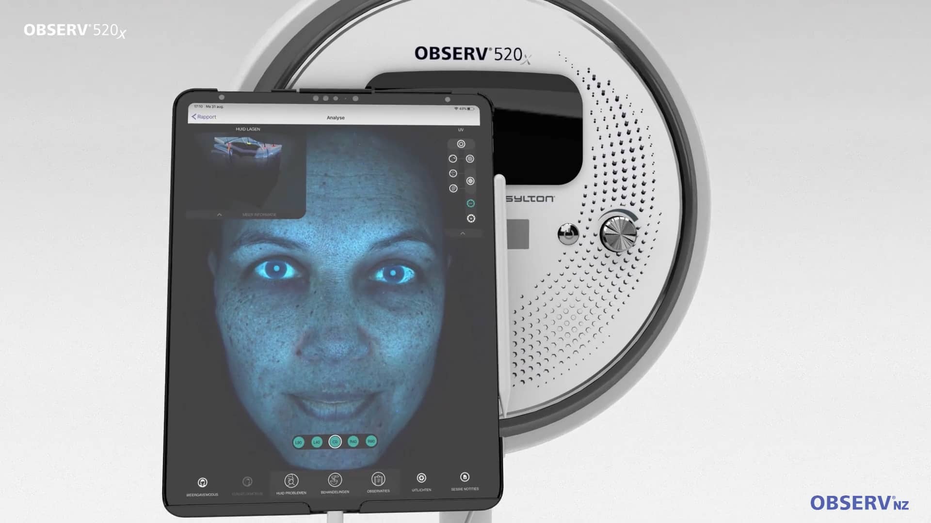 Observ 520X promo New Zealand on Vimeo