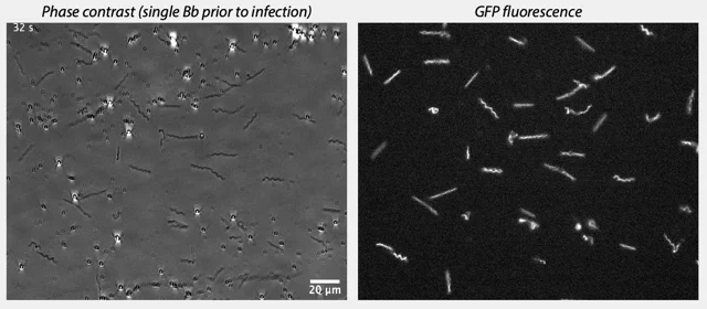 Phase Contrast Microscopy Bacteria